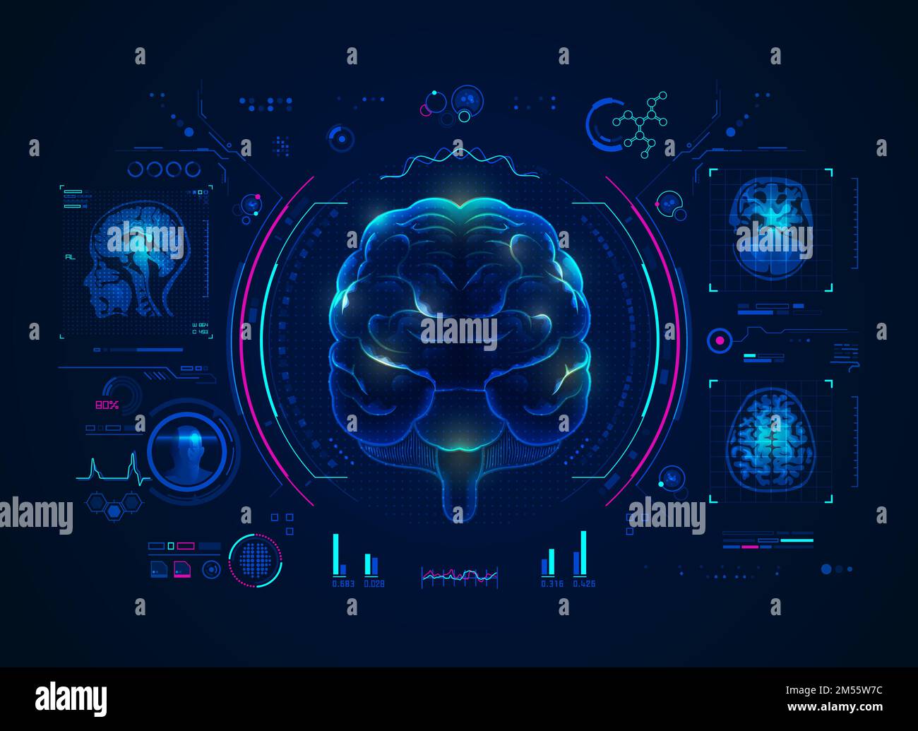 Brain monitor communication hi-res stock photography and images - Alamy