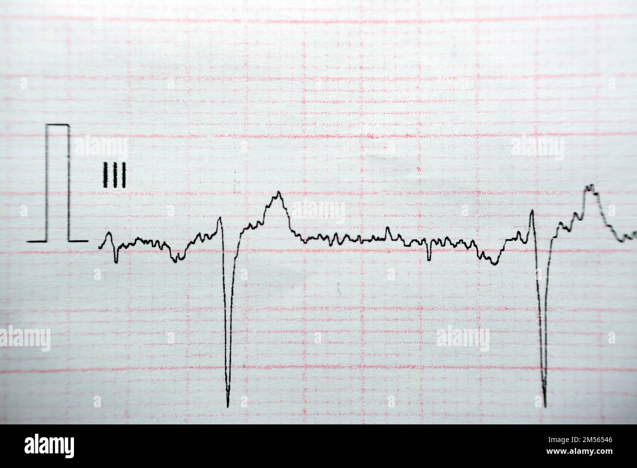 ECG ElectroCardioGraph paper that shows Normal Sinus Rhythm NSR with ...