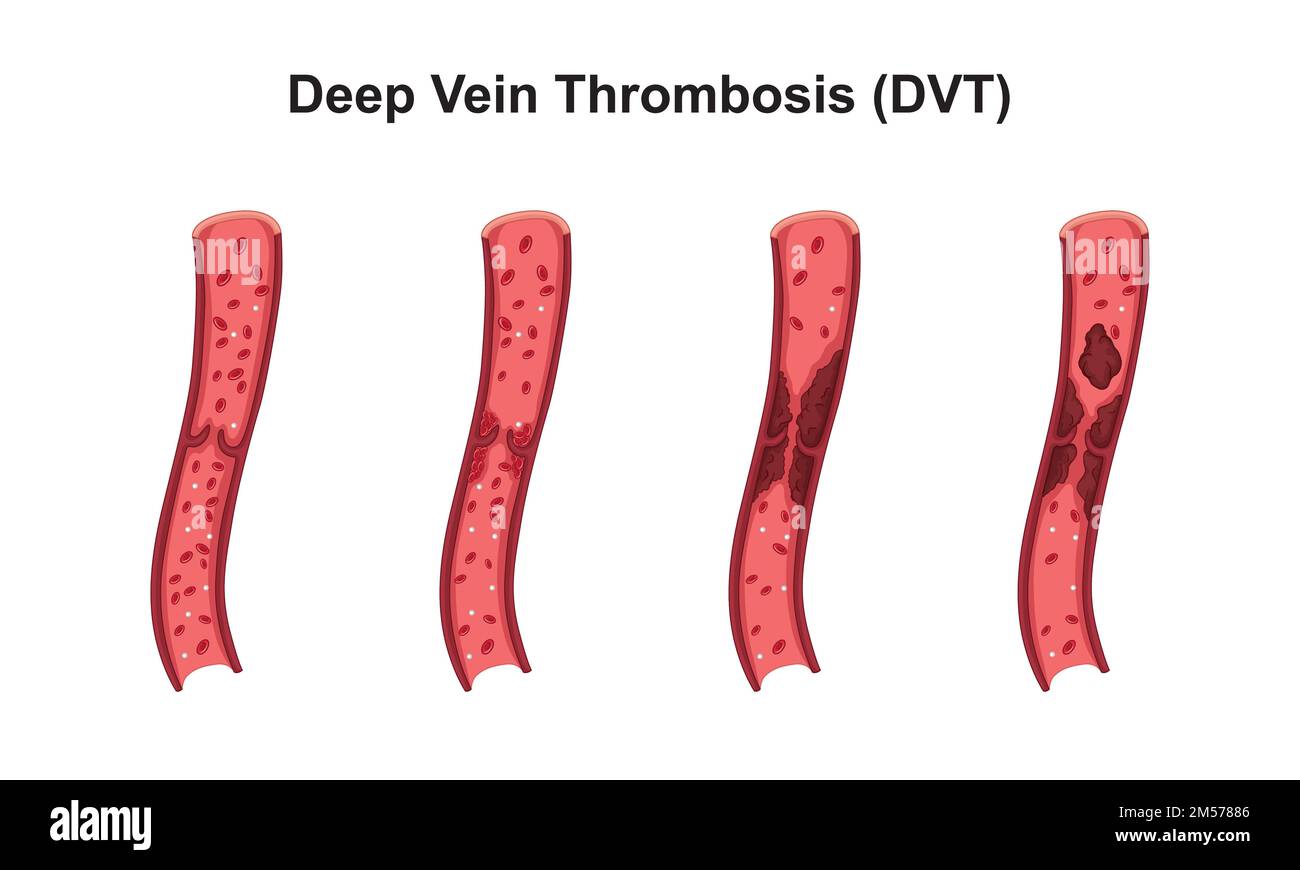 Dvt logo design hi-res stock photography and images - Alamy