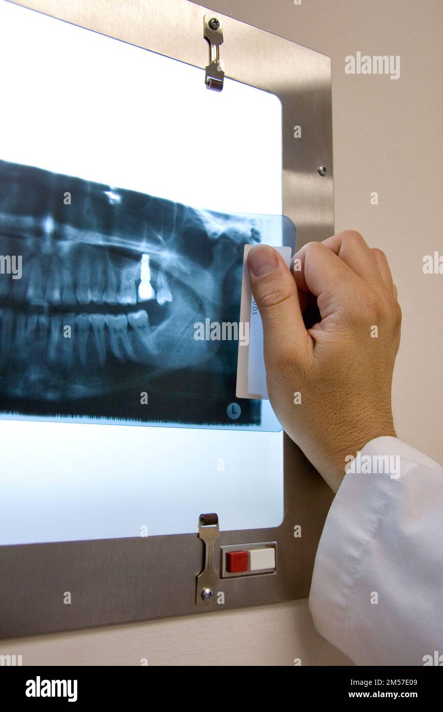 Doctor checking panoramic x-ray Stock Photo - Alamy