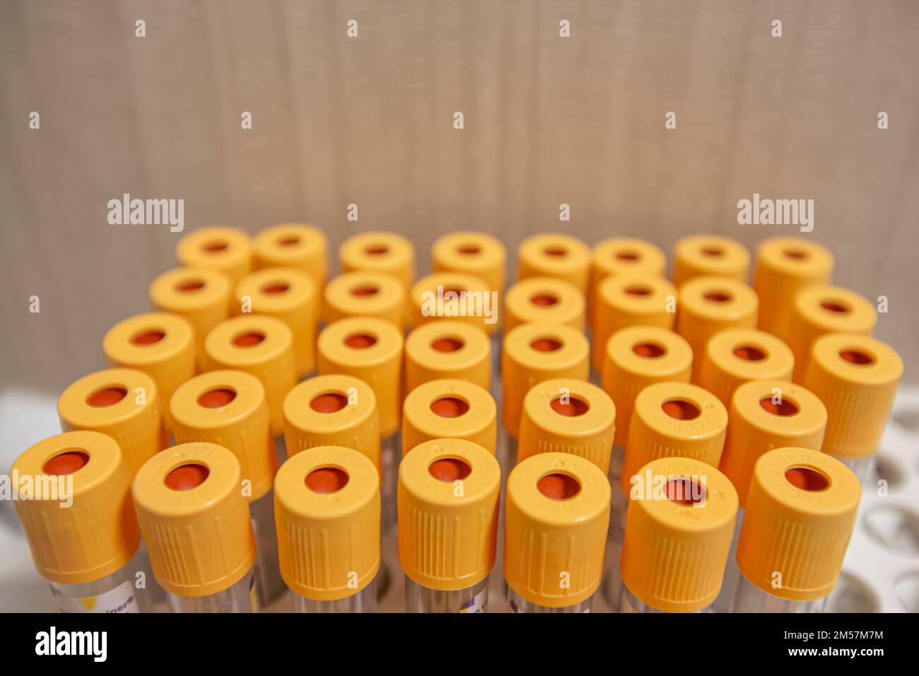 Blood sample tube from a shelf with analysis machines in the laboratory ...