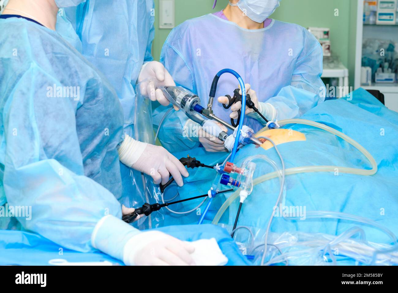 Hands of surgeons in sterile gloves with laparoscopic surgical ...