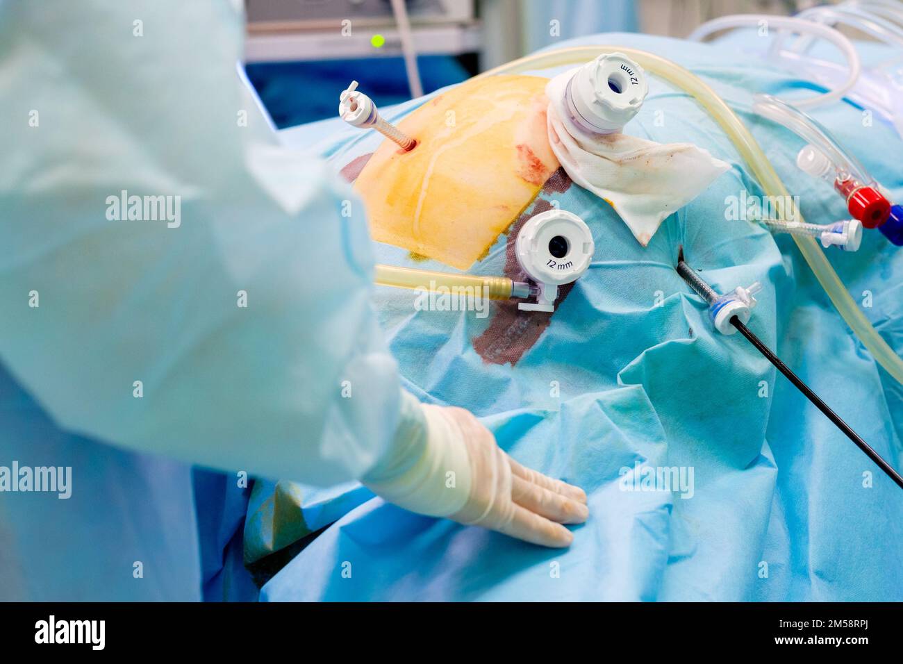 Tubes on patient during an operation hi-res stock photography and ...
