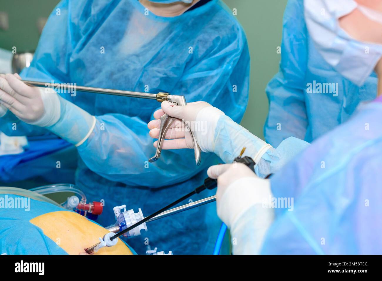 The surgeon's hand in a sterile glove holds a laparoscopic surgical ...