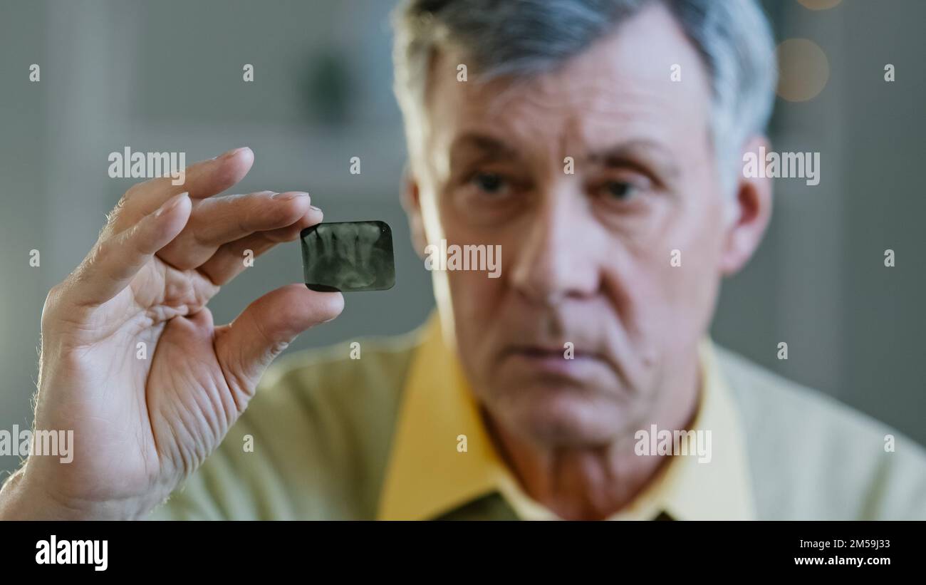 Close up sad Caucasian old senior mature man indoor patient with toothy ...