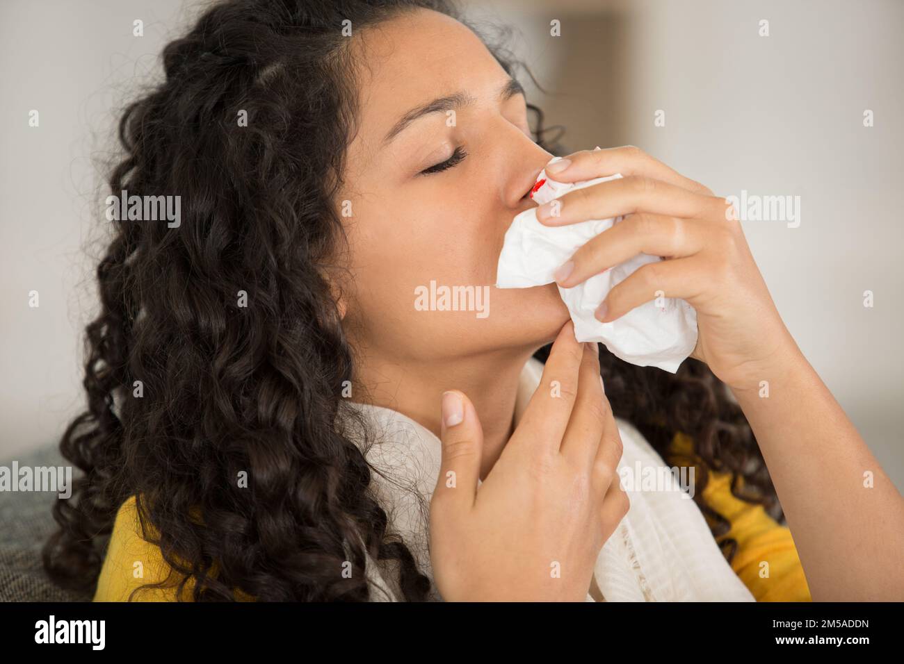 young woman bleeding from her nose Stock Photo - Alamy