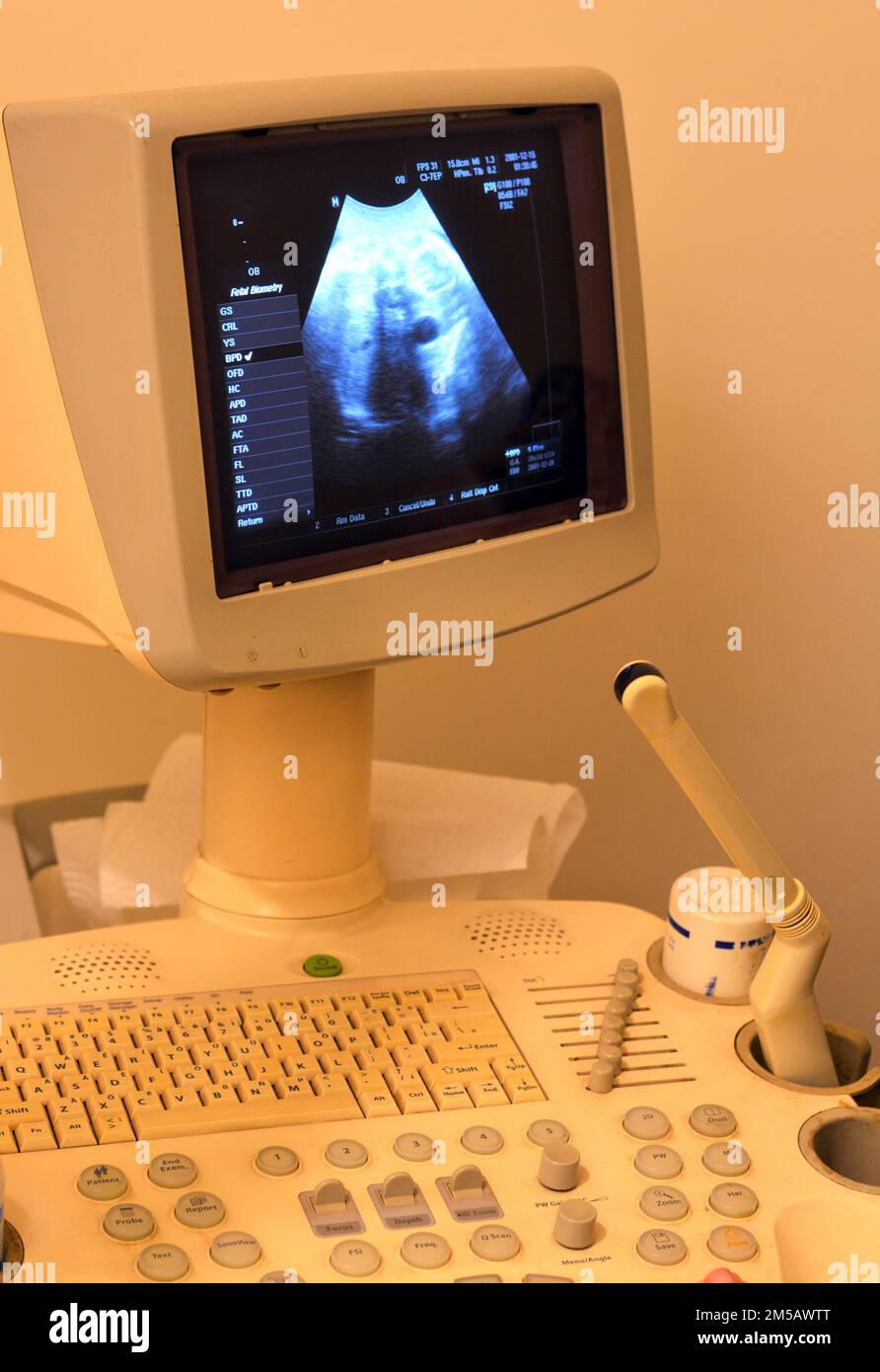 Ultrasonography on the uterus of a pregnant woman showing a healthy ...