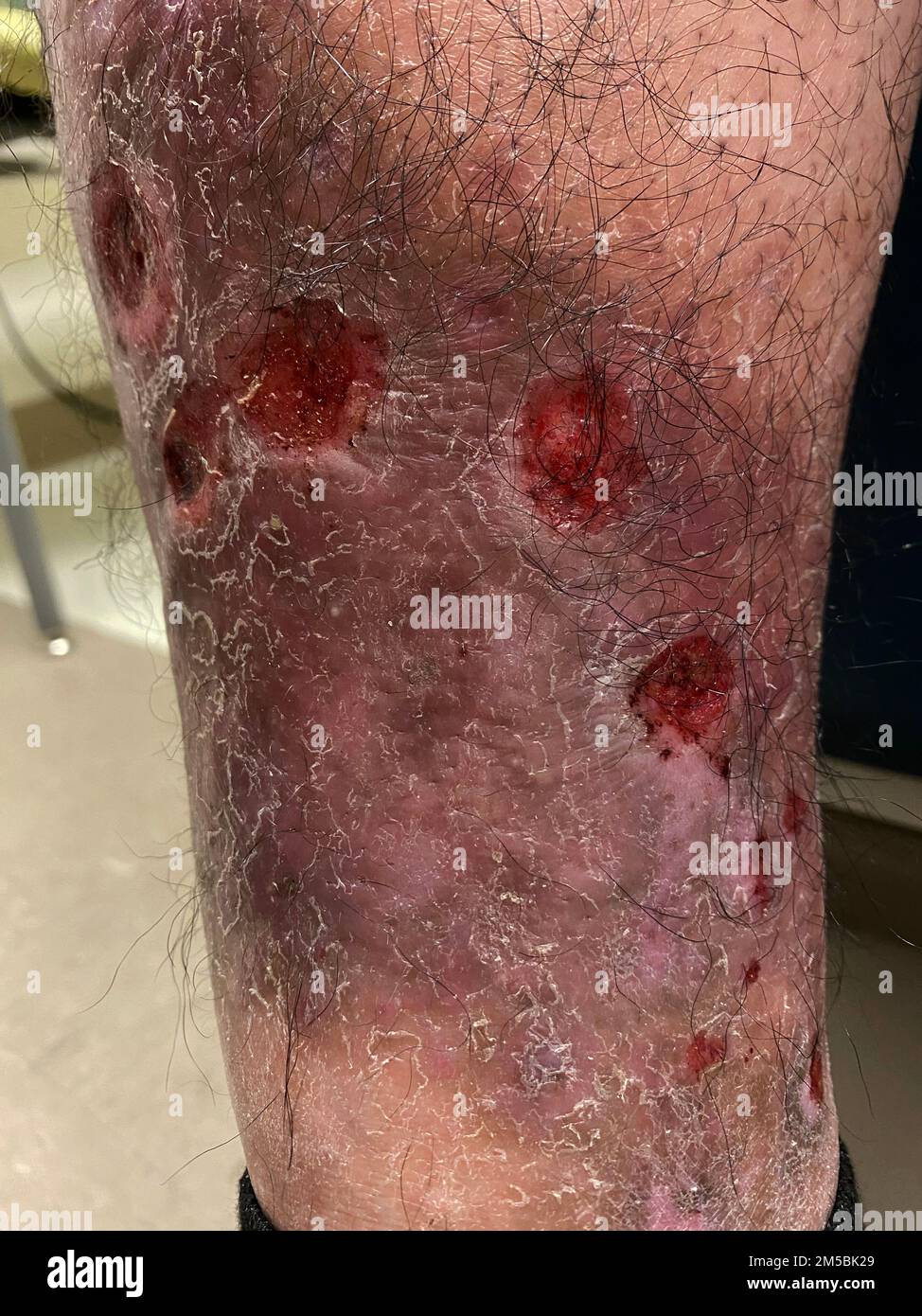 Not to be used for advertising or in a defamatory context Leg of a 42 ...