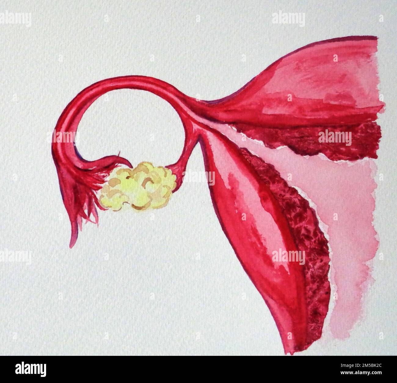 Illustration of part of the uterus (womb, right), a fallopian tube, or ...