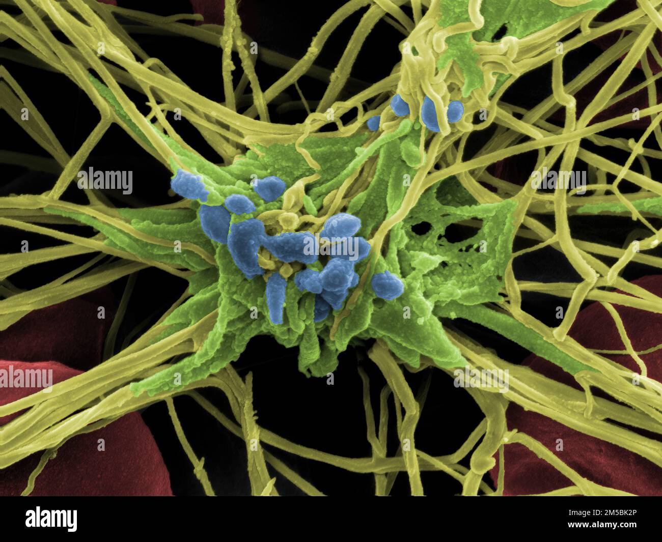 Coloured scanning electron micrograph (SEM) showing an activated ...