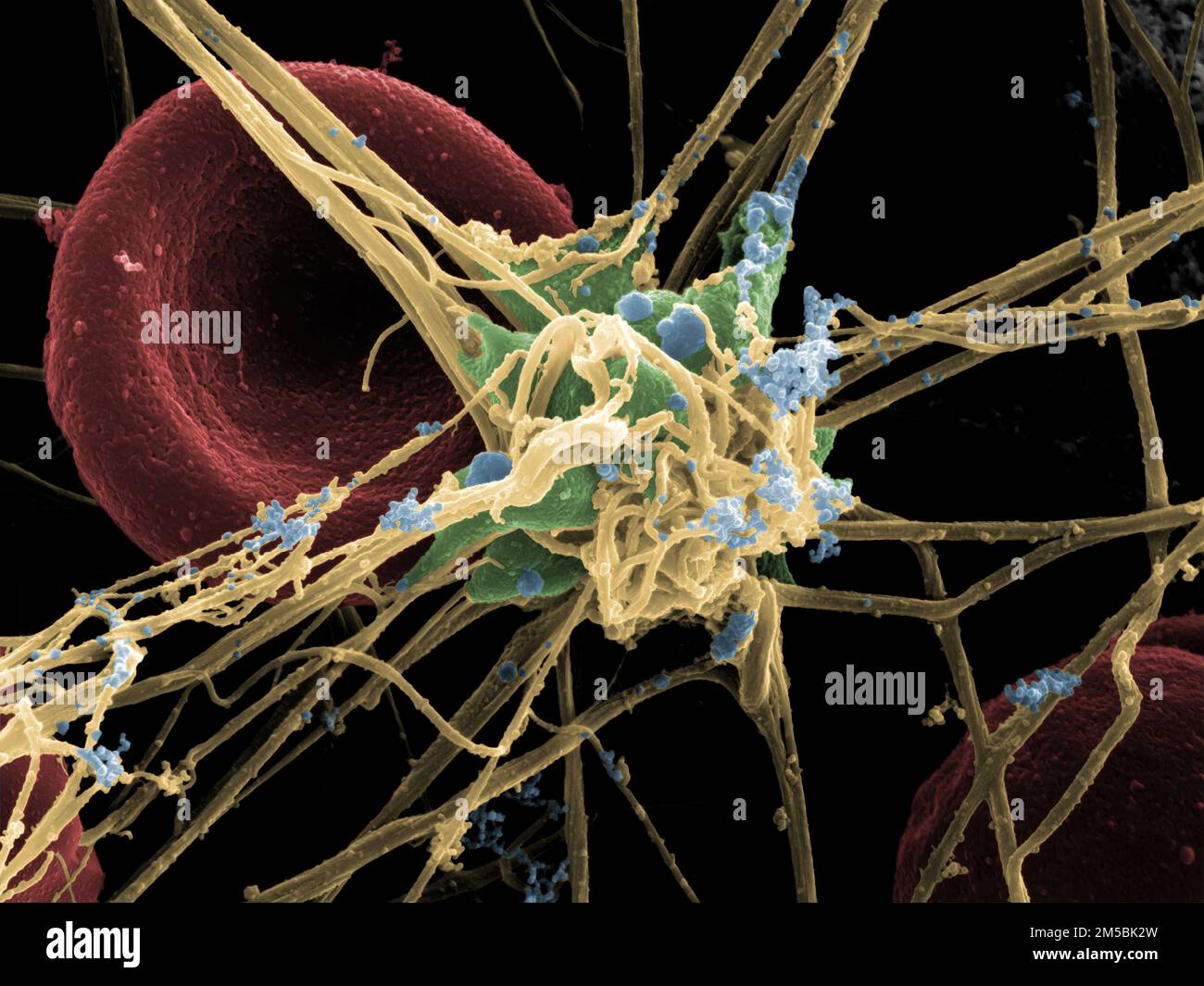 Coloured scanning electron micrograph (SEM) showing an activated ...