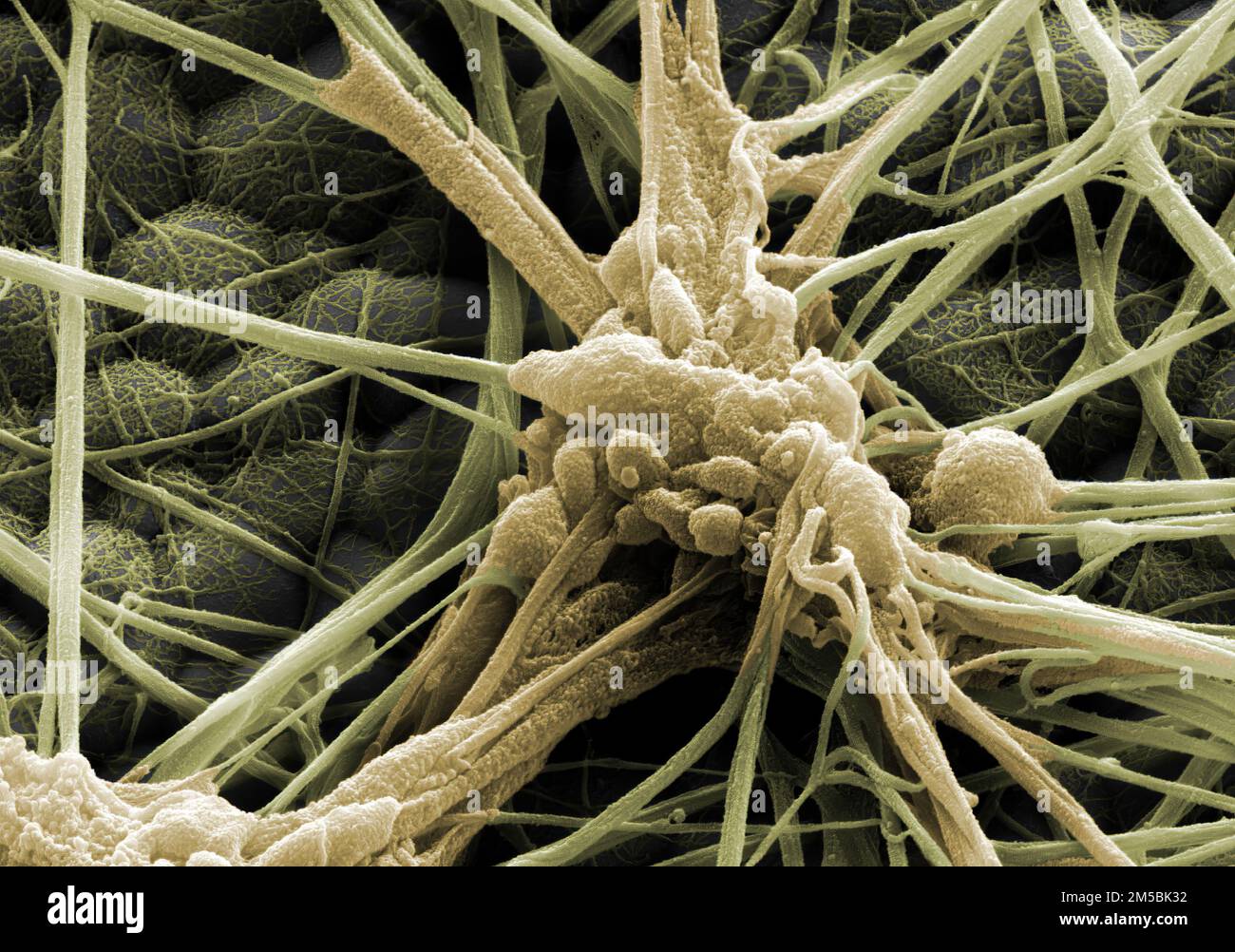 Coloured scanning electron micrograph (SEM) showing an activated ...