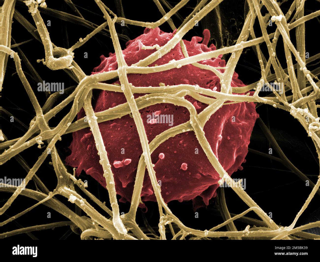 Coloured scanning electron micrograph (SEM) of a leucocyte (white blood ...