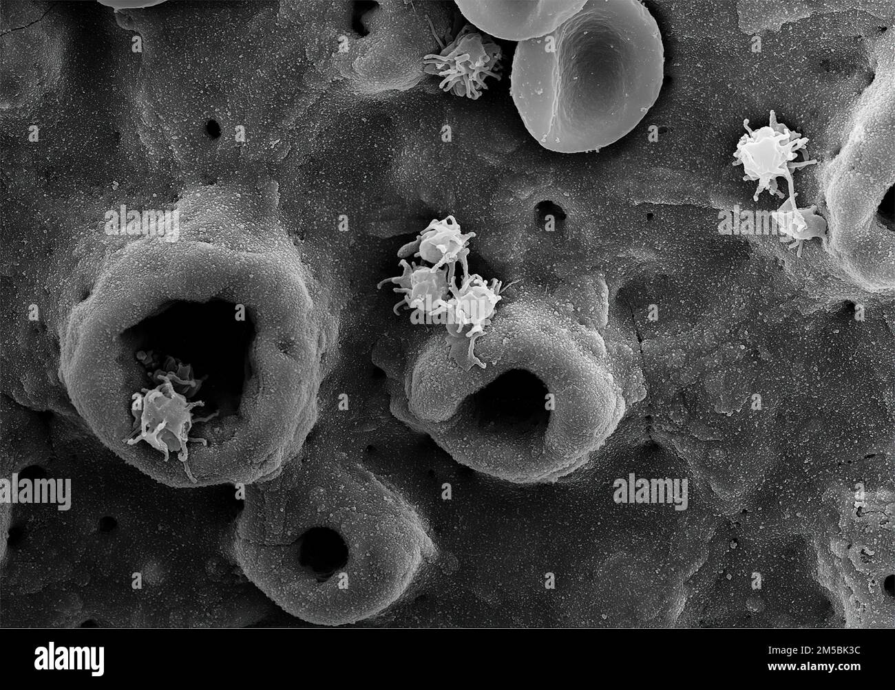 Scanning electron micrograph (SEM) showing activated platelets ...