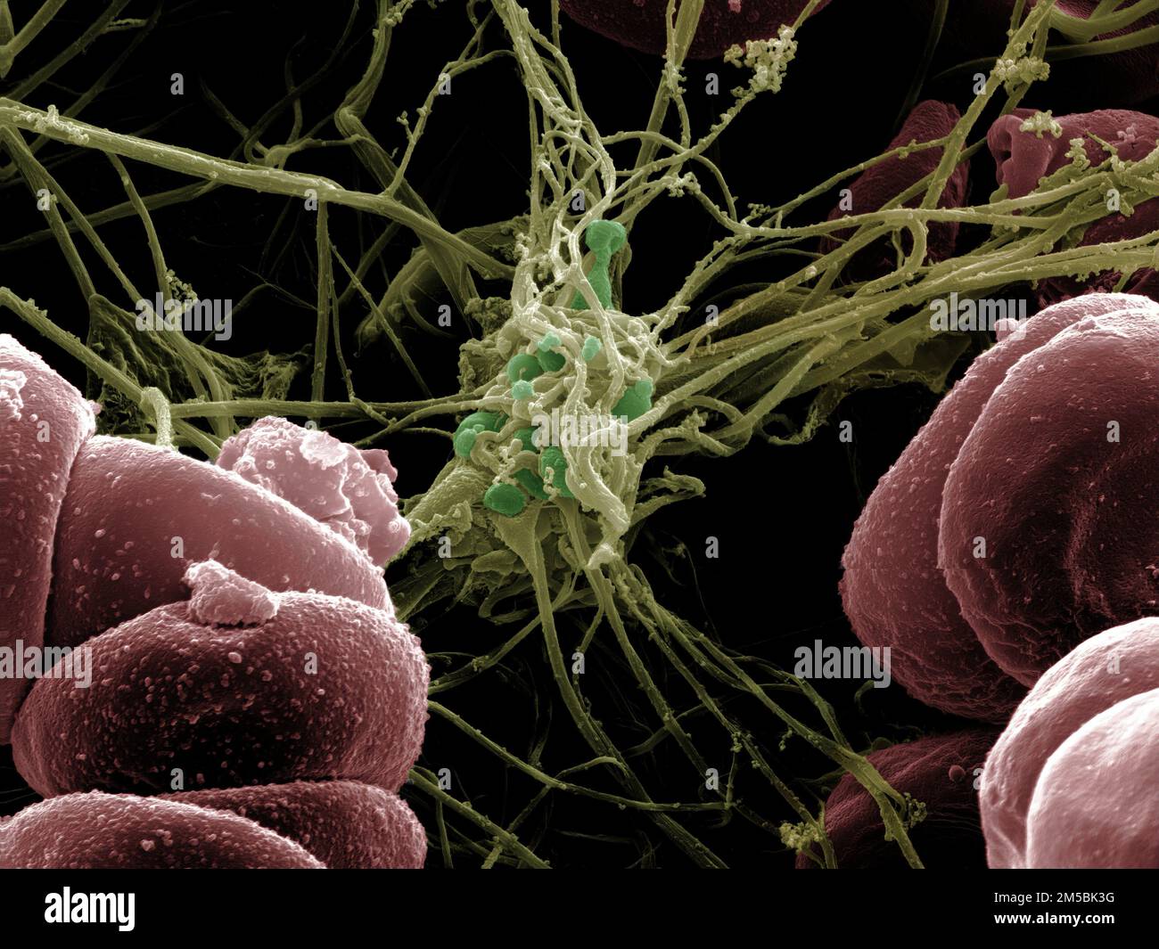 Coloured scanning electron micrograph (SEM) showing an activated ...