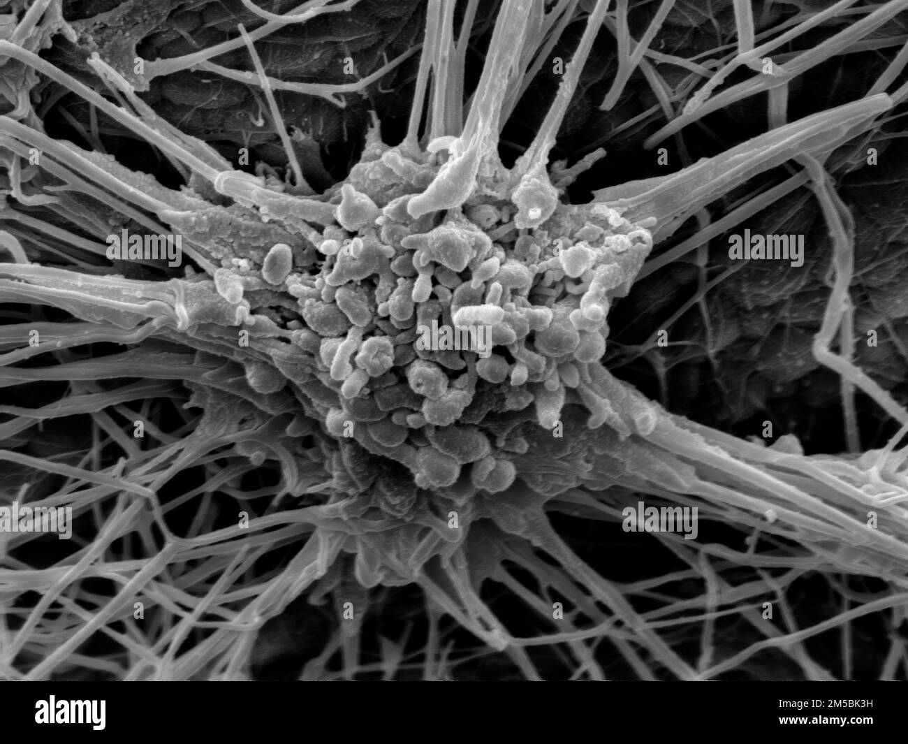 Scanning electron micrograph (SEM) showing an activated platelet ...
