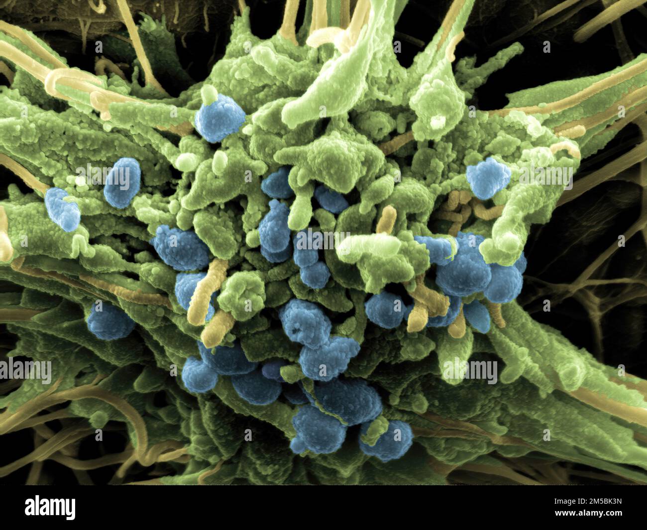 Coloured scanning electron micrograph (SEM) showing an activated ...