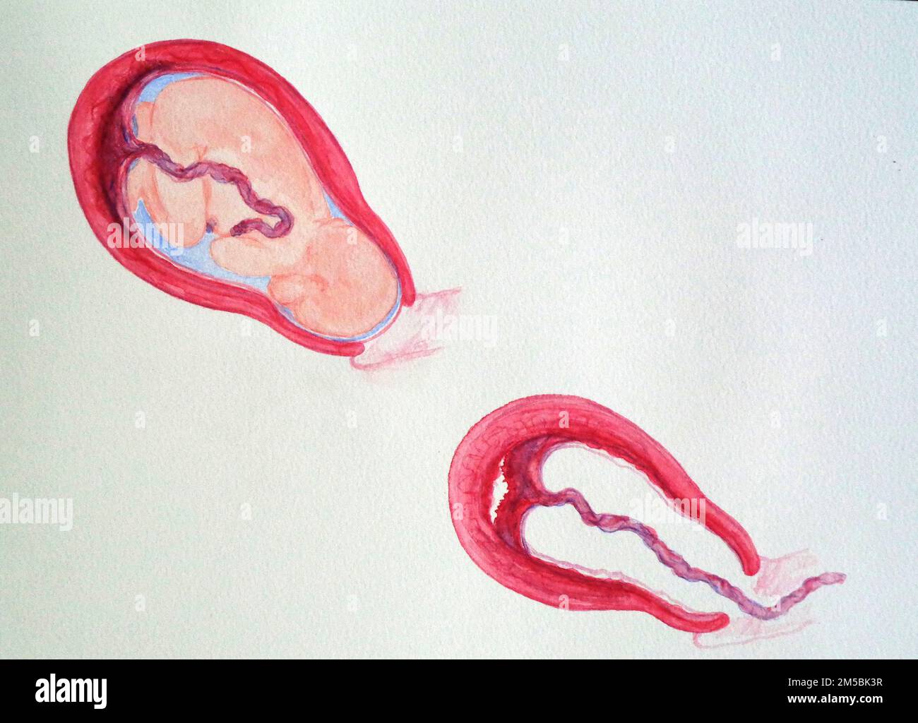 Childbirth, illustration. At top left the foetus is in the normal head ...