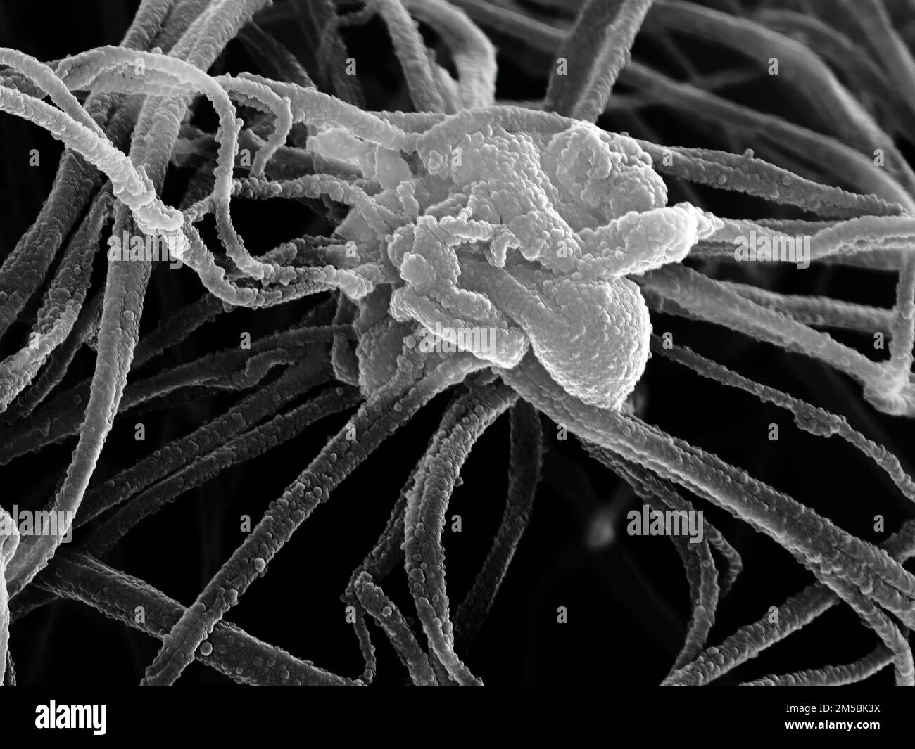Scanning electron micrograph (SEM) showing an activated platelet ...