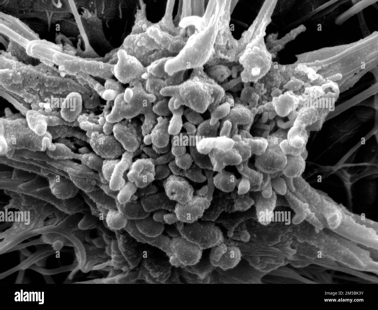 Scanning electron micrograph (SEM) showing an activated platelet (thrombocyte) trapped in a mesh ...