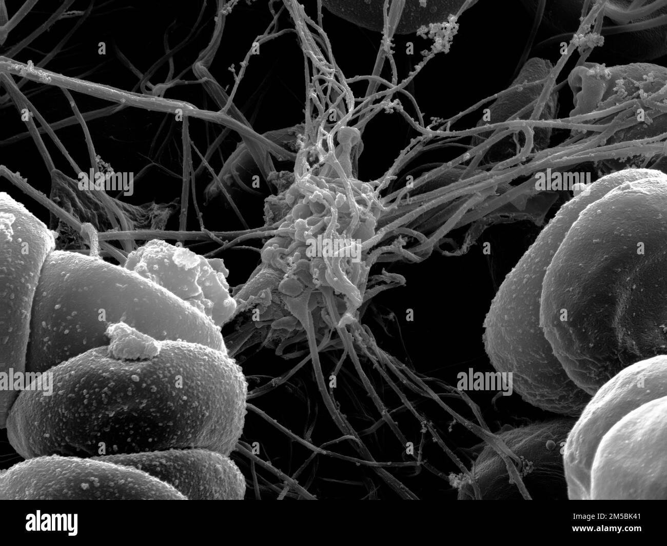 Scanning electron micrograph (SEM) showing an activated platelet (thrombocyte) trapped in a mesh ...