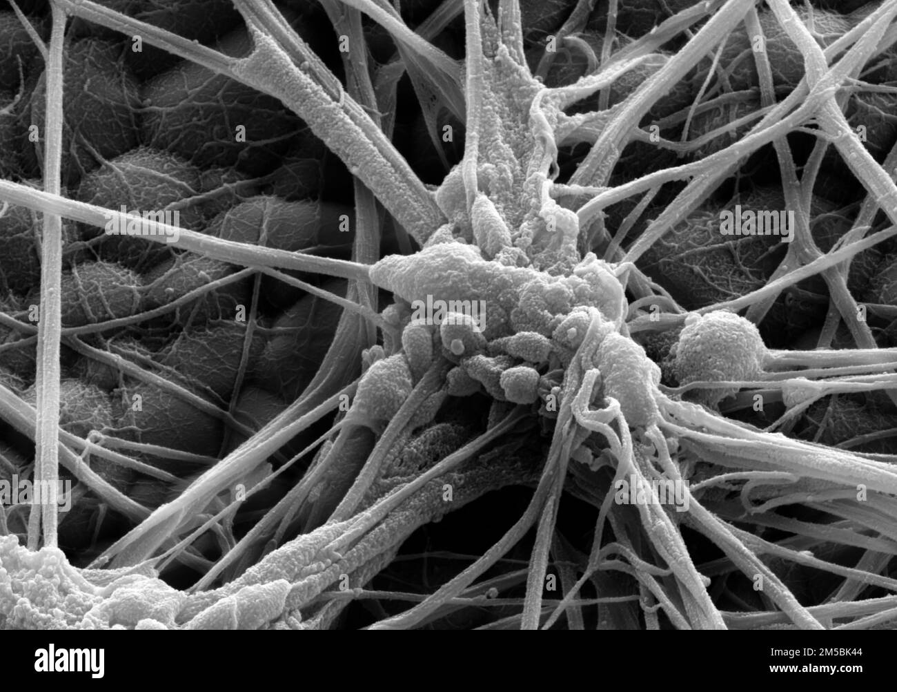 Scanning electron micrograph (SEM) showing an activated platelet ...