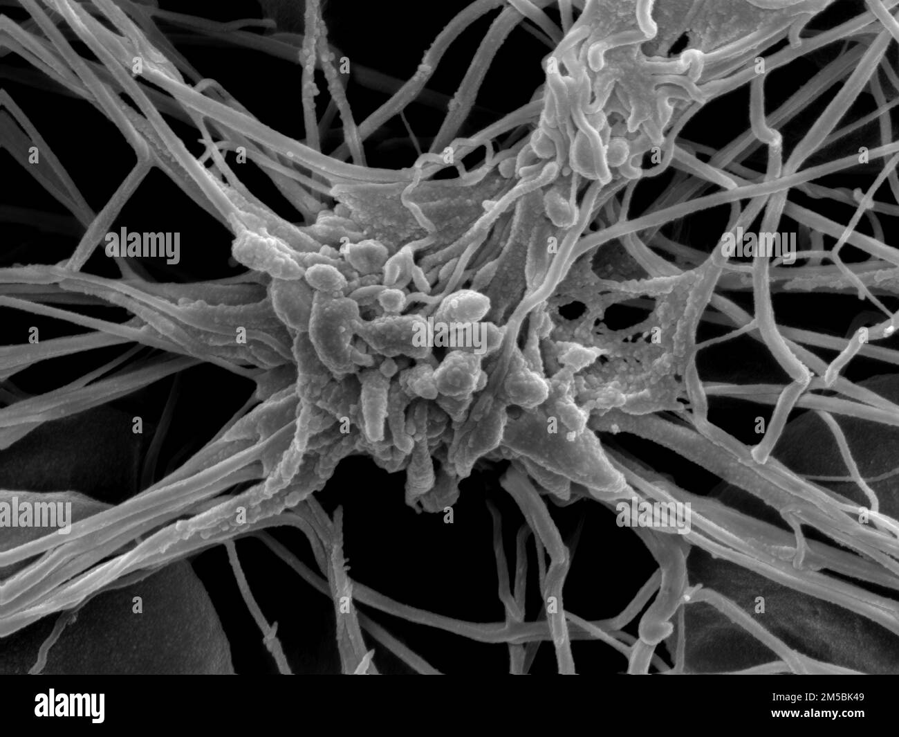 Scanning electron micrograph (SEM) showing an activated platelet ...