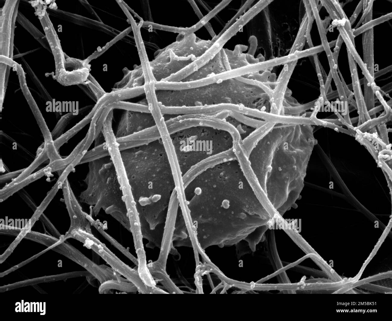 Scanning electron micrograph (SEM) of a leucocyte (white blood cell ...