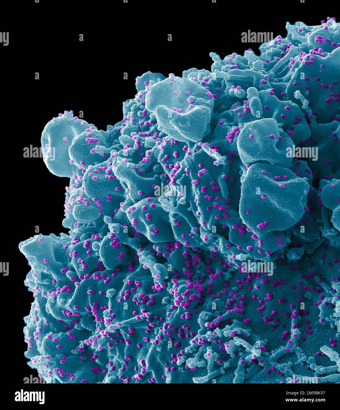 SARS-CoV-2 Omicron variant. Coloured scanning electron micrograph (SEM ...