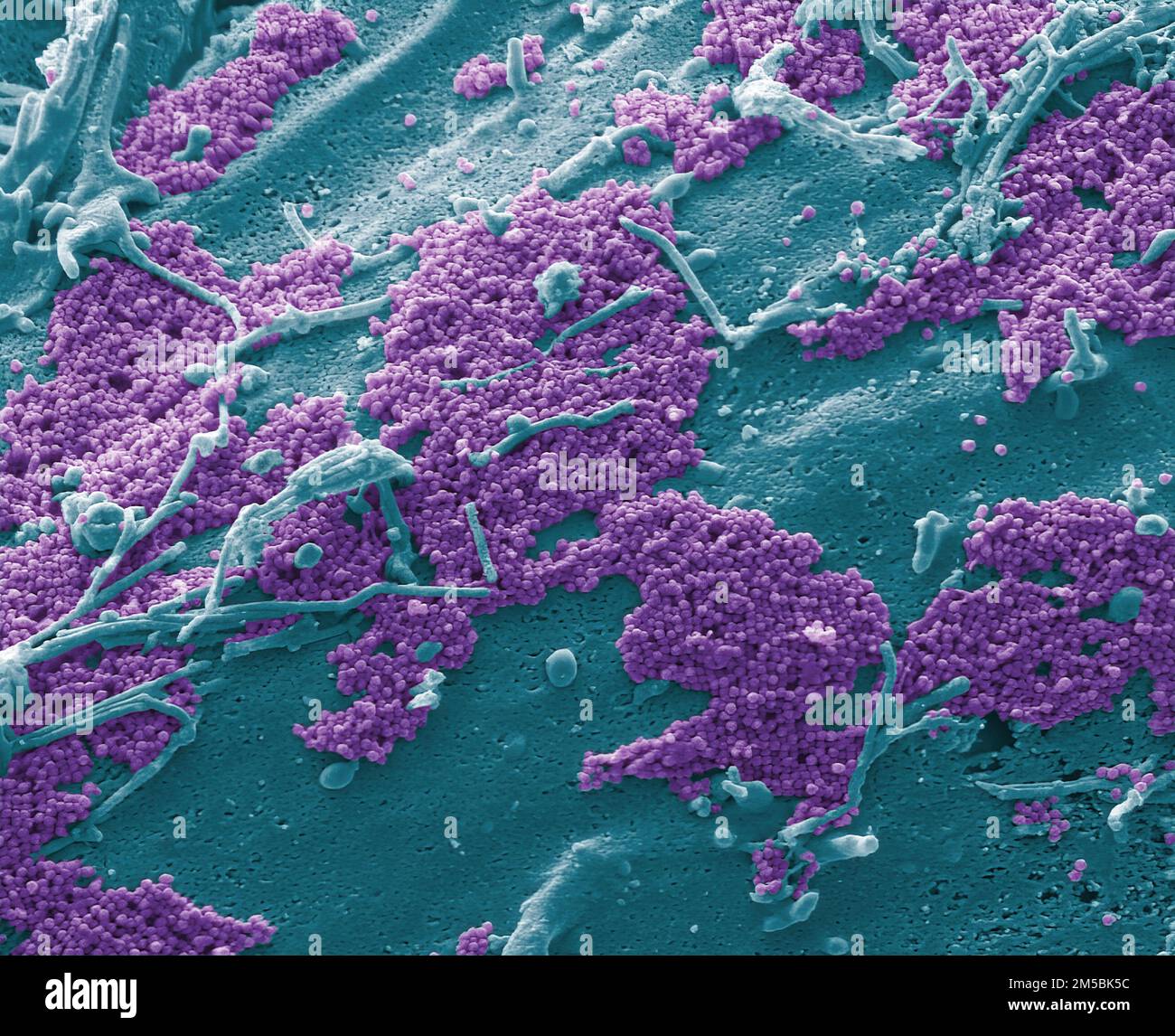 Human cells infected with influenza virus, coloured scanning electron ...