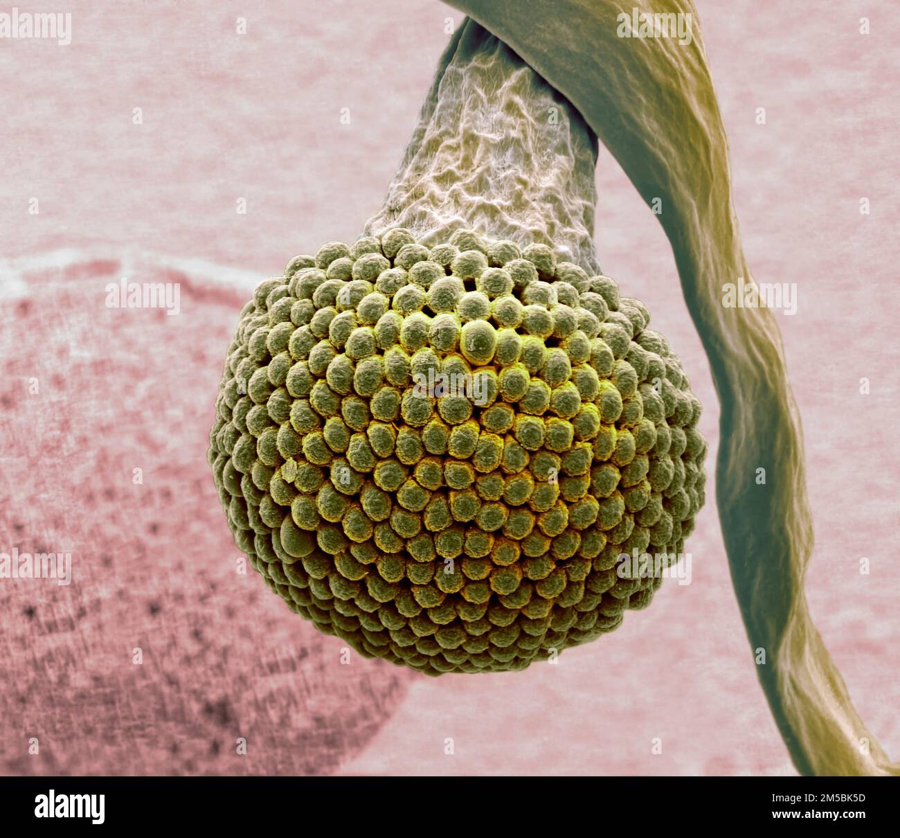 Oral fungal microbiota. Coloured scanning electron micrograph (SEM) of ...