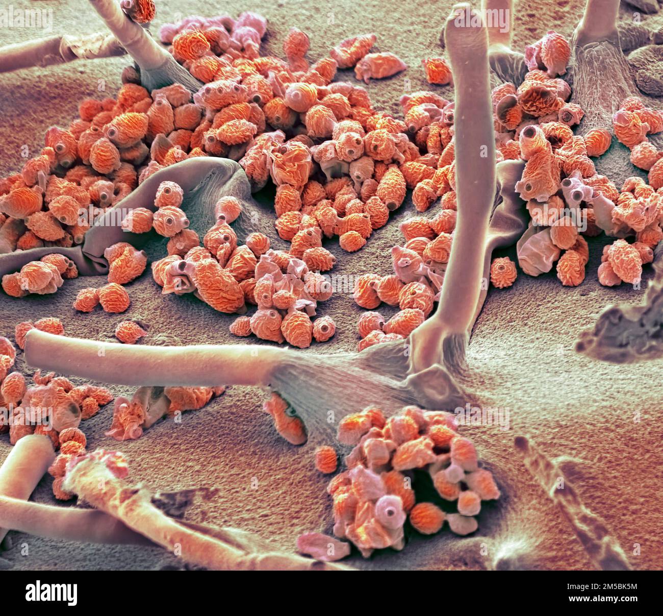 Oral fungi. Coloured scanning electron micrograph (SEM) of a culture ...
