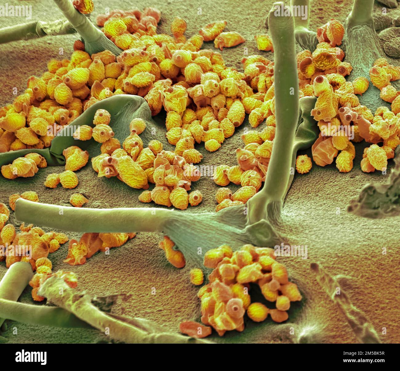Oral fungi. Coloured scanning electron micrograph (SEM) of a culture ...