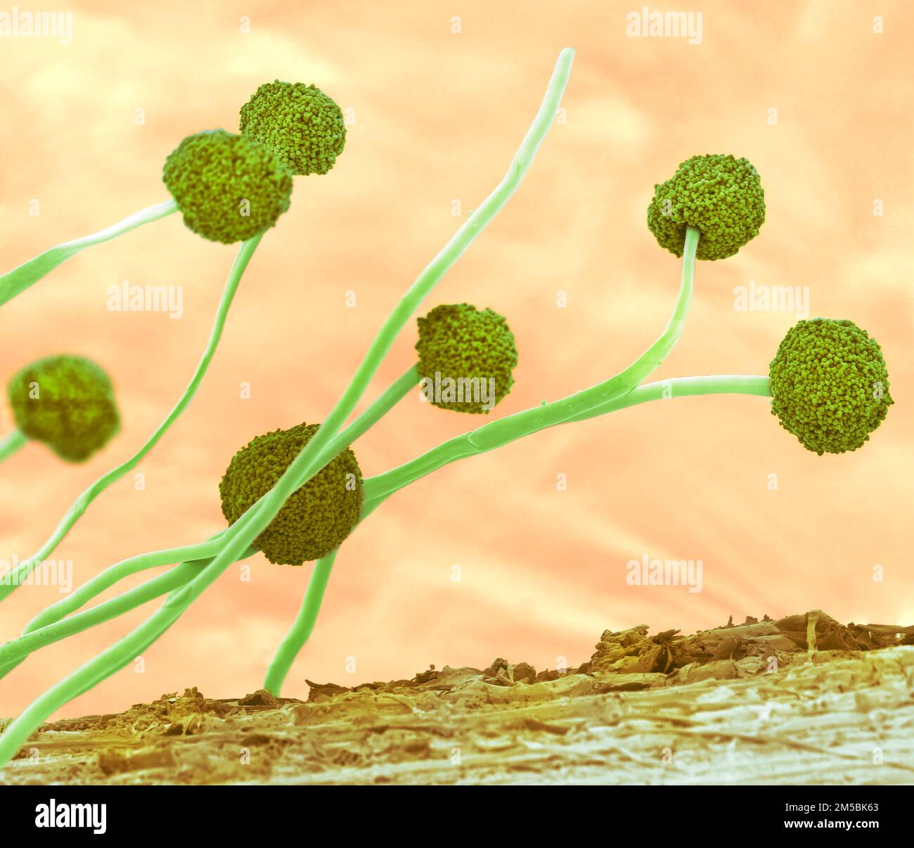Oral fungal microbiota. Coloured scanning electron micrograph (SEM) of ...
