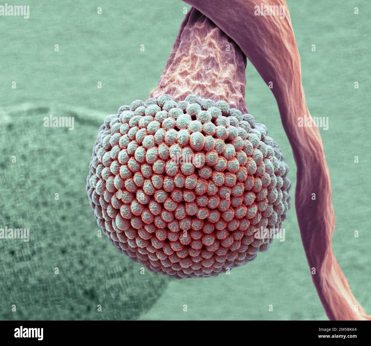 Oral fungal microbiota. Coloured scanning electron micrograph (SEM) of ...