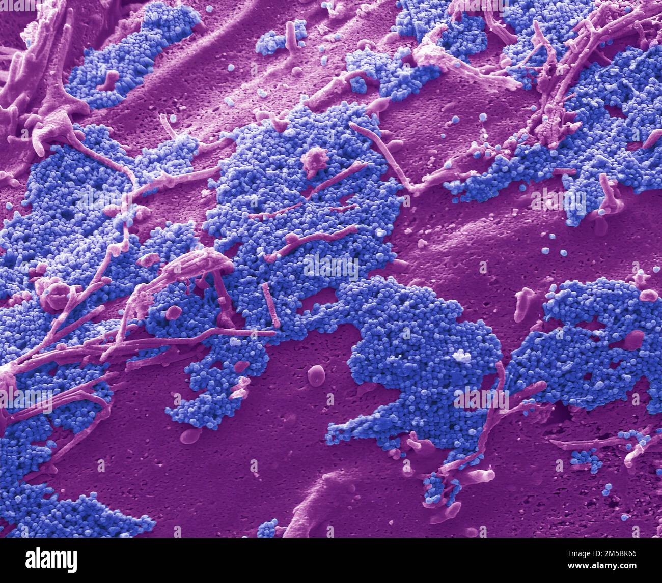 Human cells infected with influenza virus, coloured scanning electron ...