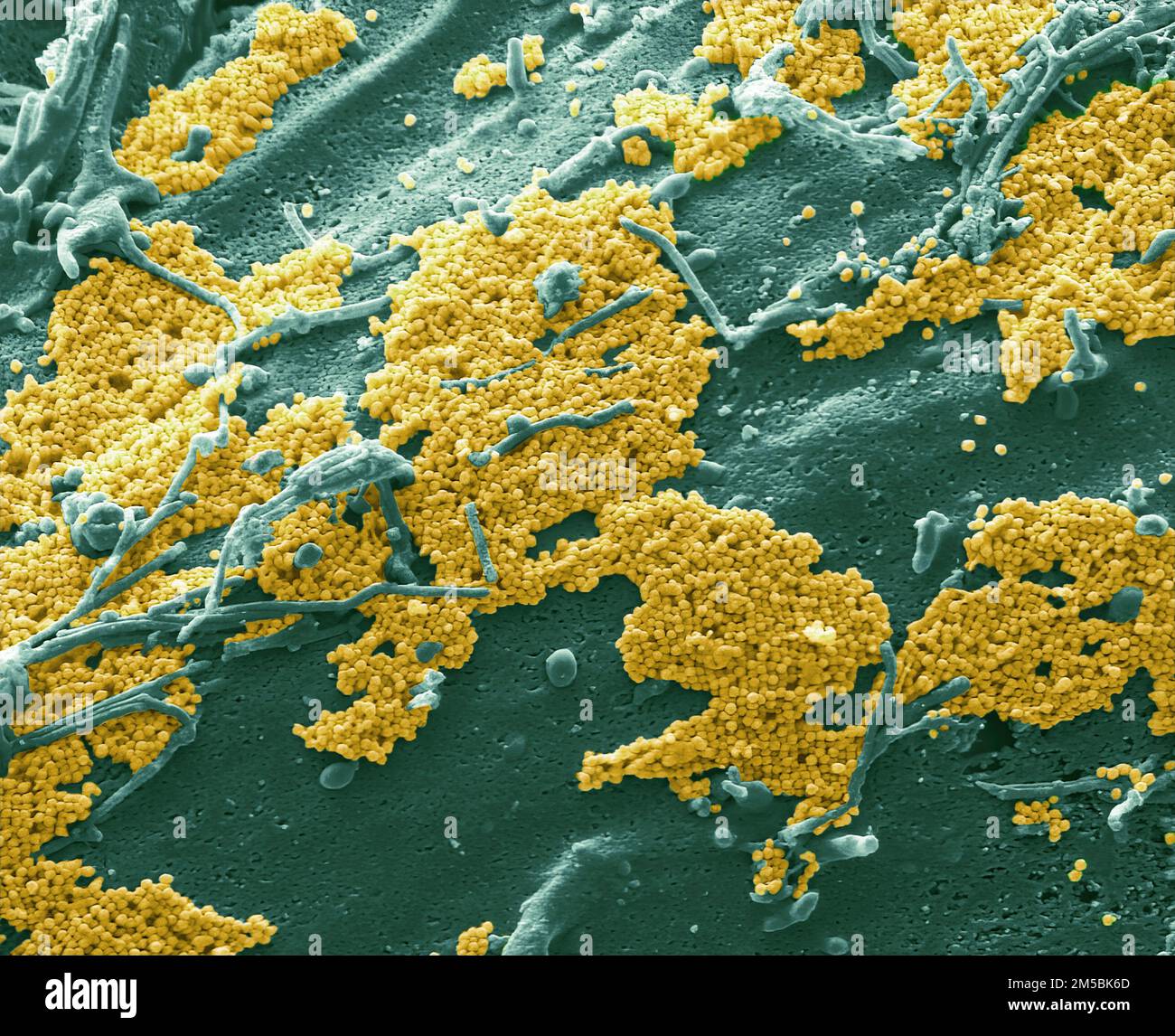 Human cells infected with influenza virus, coloured scanning electron ...