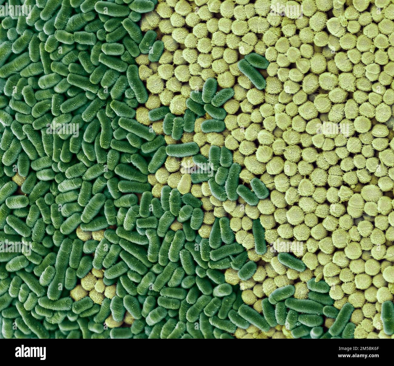 Urinary Tract Infection Bacteria Microscope