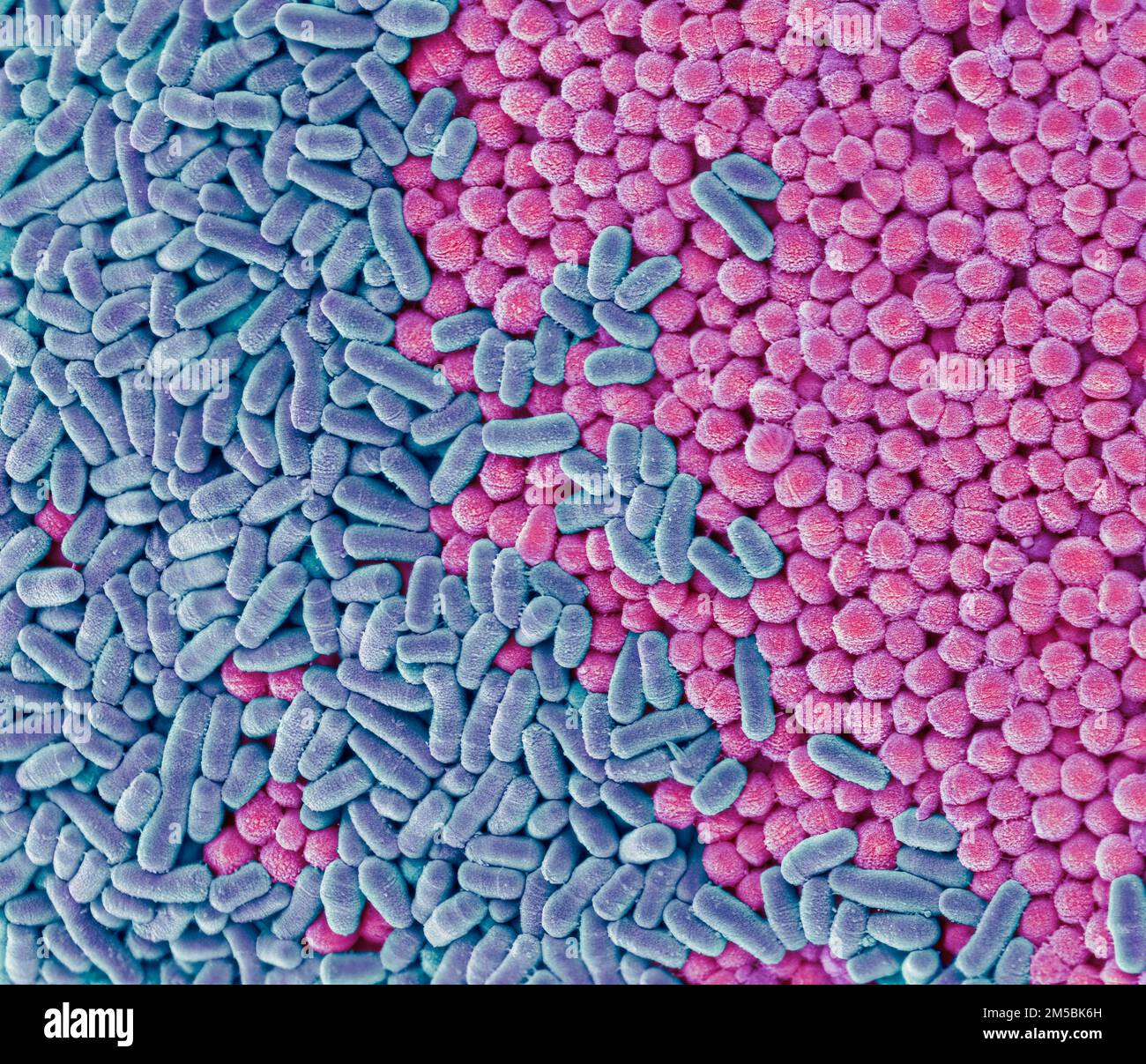 Bacteria culture from urine. Coloured scanning electron micrograph (SEM ...