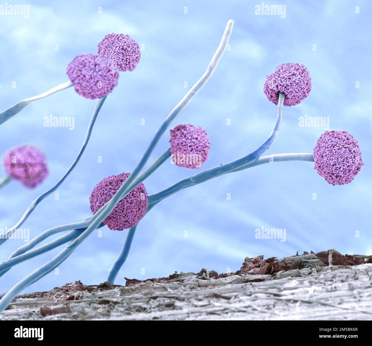 Oral fungal microbiota. Coloured scanning electron micrograph (SEM) of fruiting bodies of the ...