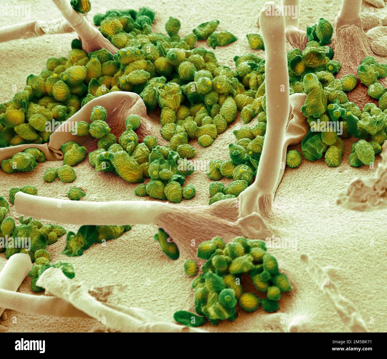 Oral fungi. Coloured scanning electron micrograph (SEM) of a culture ...
