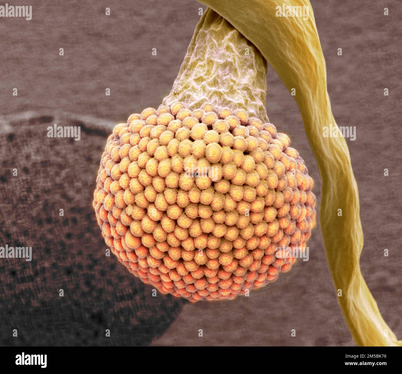 Oral fungal microbiota. Coloured scanning electron micrograph (SEM) of a fruiting body of the ...