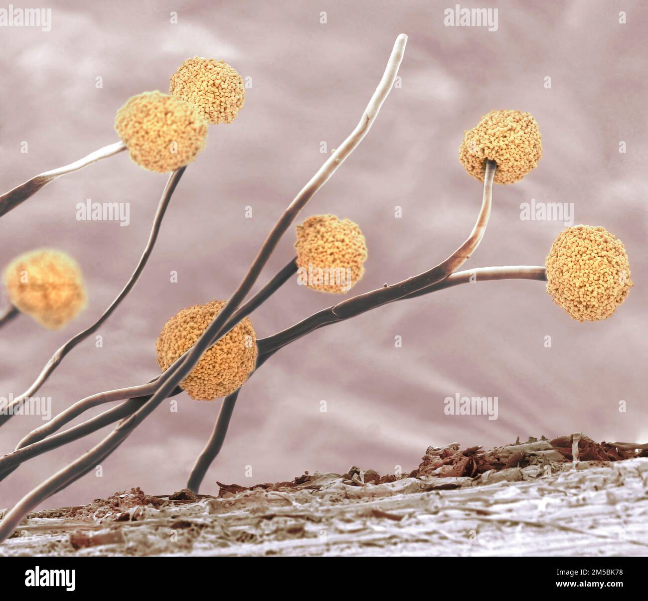 Oral fungal microbiota. Coloured scanning electron micrograph (SEM) of ...