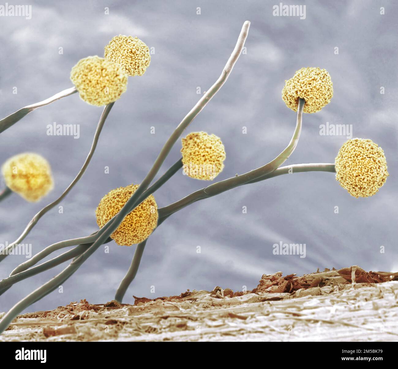 Oral fungal microbiota. Coloured scanning electron micrograph (SEM) of ...