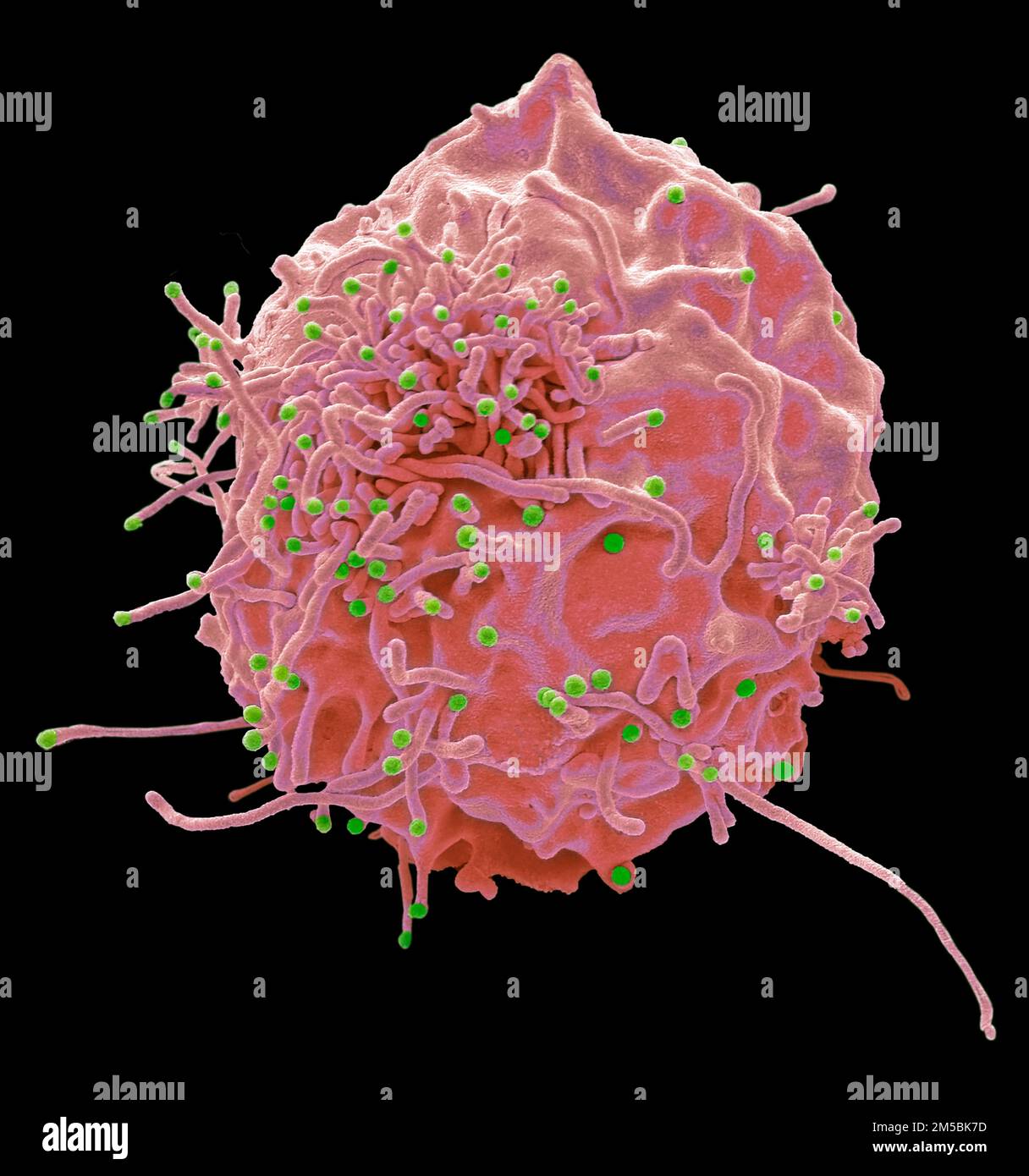 HIV. Scanning electron micrograph (SEM) of viral vectors based on HIV (human immunodeficiency ...