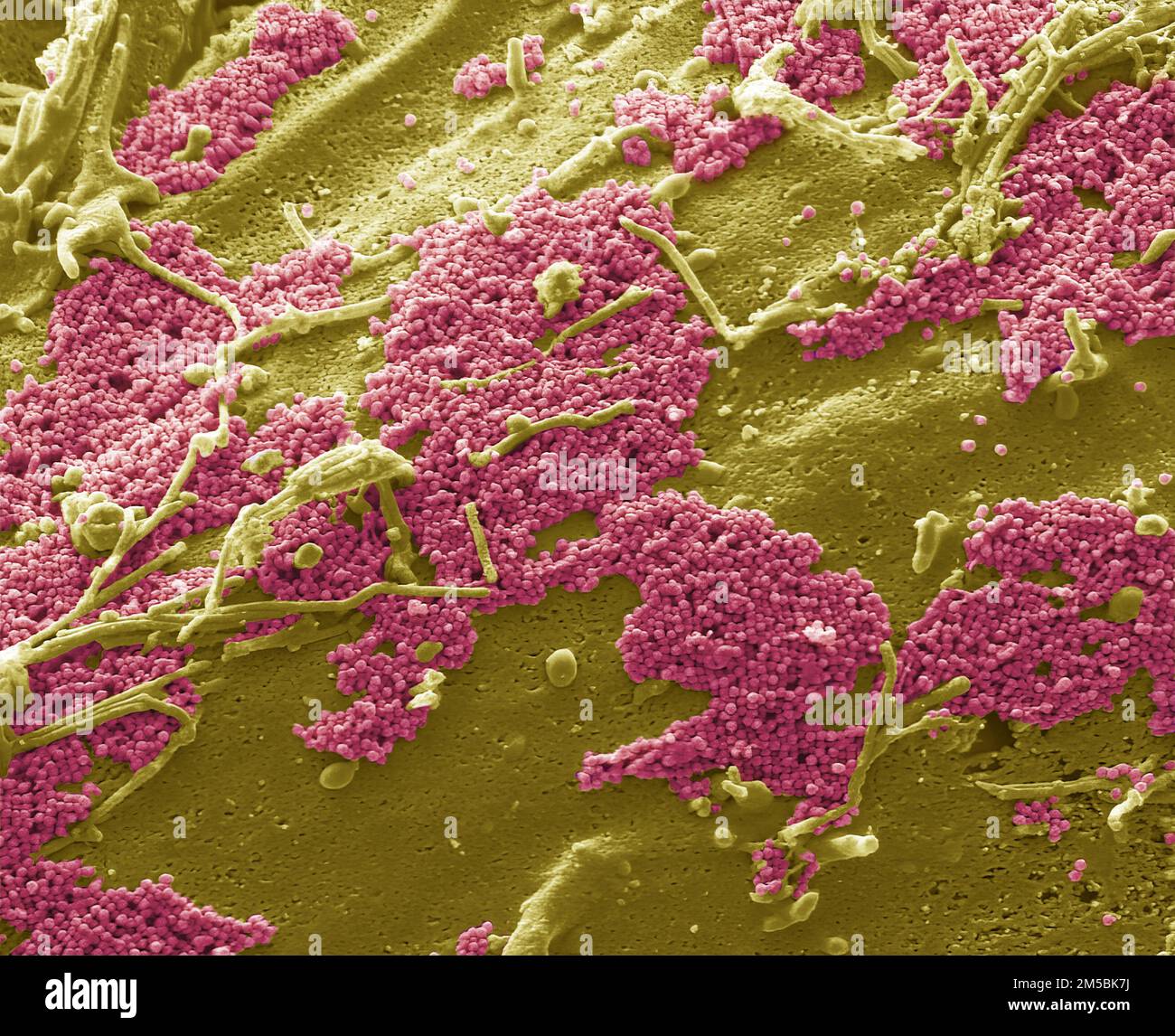 Human cells infected with influenza virus, coloured scanning electron ...