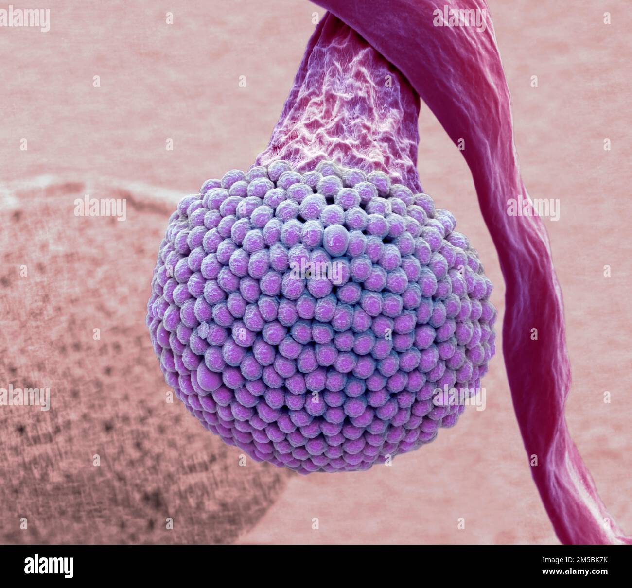 Oral fungal microbiota. Coloured scanning electron micrograph (SEM) of a fruiting body of the ...
