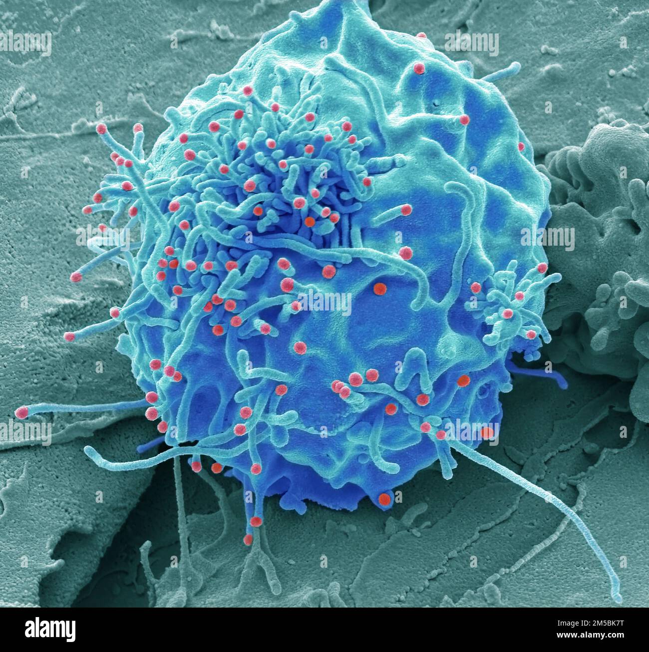 HIV. Scanning electron micrograph (SEM) of viral vectors based on HIV ...