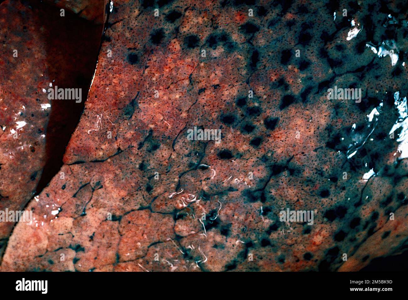 Close-up of the surface of a human lung with anthracosis, a disease ...