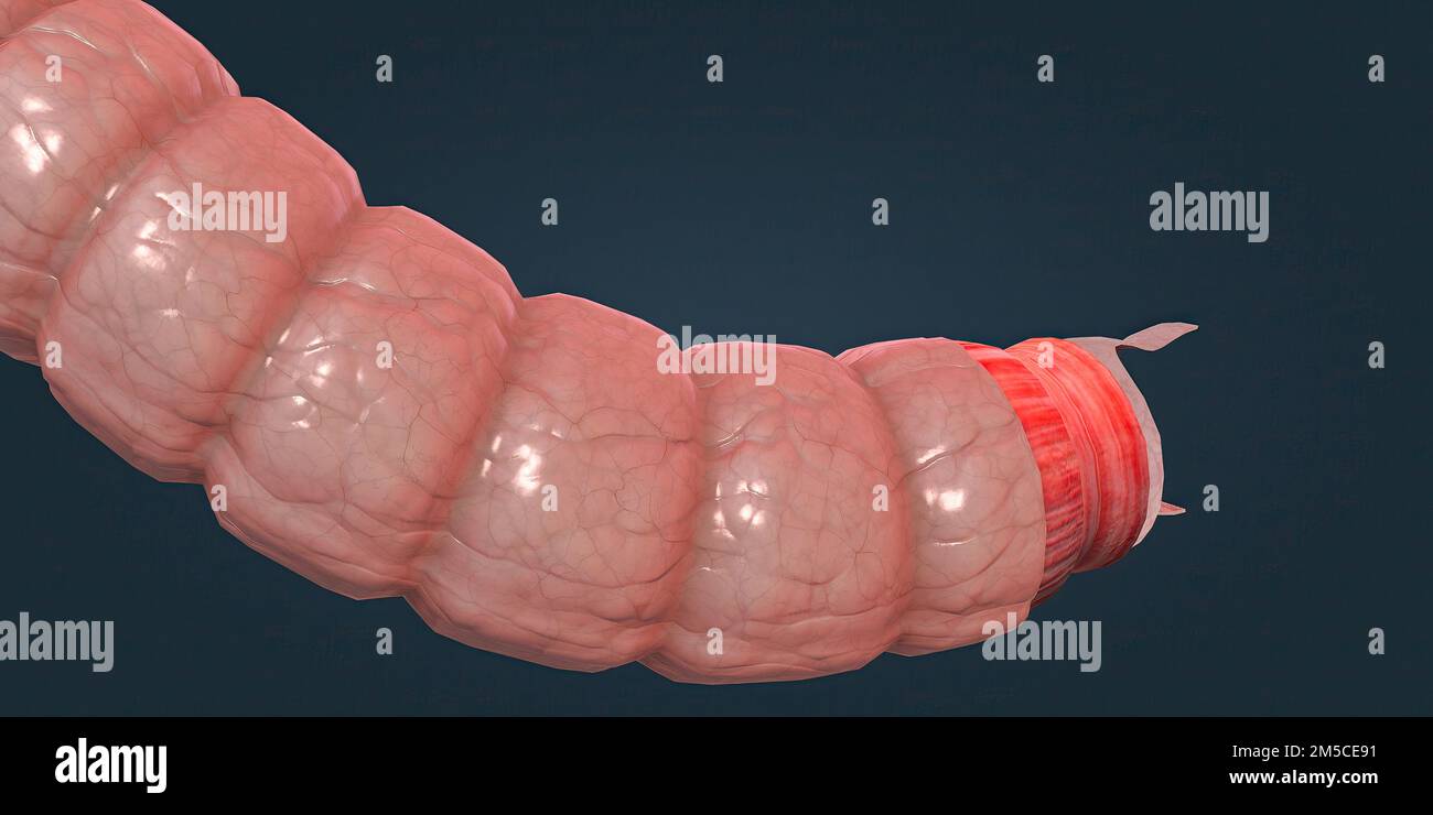 Villus cross section hi-res stock photography and images - Alamy